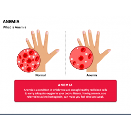 Free Anemia PowerPoint and Google Slides Template - PPT Slides