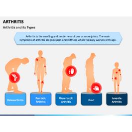 Rheumatoid Arthritis Powerpoint Presentations