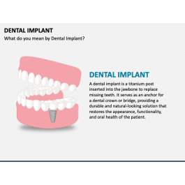 Dental Implant PowerPoint and Google Slides Template - PPT Slides