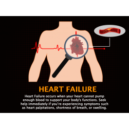 Heart Failure PowerPoint and Google Slides Template - PPT Slides