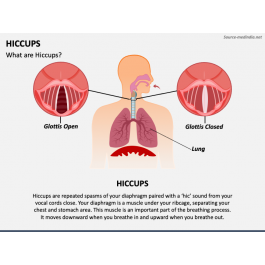 Hiccups PowerPoint and Google Slides Template - PPT Slides