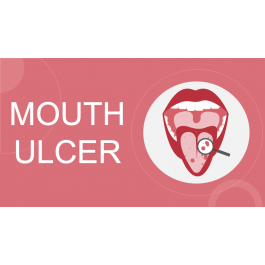 Mouth Ulcer PowerPoint and Google Slides Template - PPT Slides