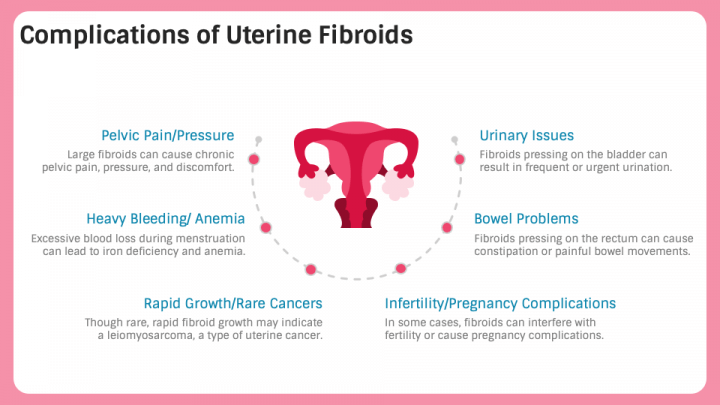Uterine Fibroid PowerPoint and Google Slides Template - PPT Slides