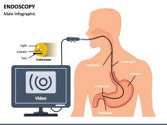 Endoscopy PowerPoint and Google Slides Template - PPT Slides