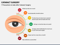 Cataract Surgery PowerPoint and Google Slides Template - PPT Slides