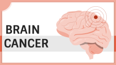 Brain Cancer PowerPoint and Google Slides Template - PPT Slides