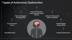 Autonomic Dysfunction PowerPoint and Google Slides Template - PPT Slides