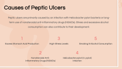 Peptic Ulcers PowerPoint and Google Slides Template - PPT Slides