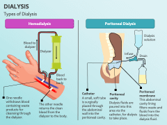 Dialysis PowerPoint and Google Slides Template - PPT Slides
