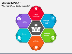 Dental Implant PowerPoint and Google Slides Template - PPT Slides