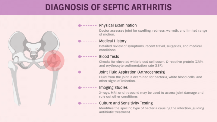 Septic Arthritis PowerPoint and Google Slides Template - PPT Slides