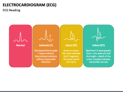 Free - Electrocardiogram (ECG) PowerPoint and Google Slides Template ...