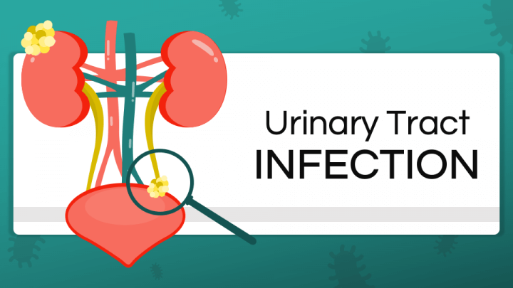 Urinary Tract Infection PowerPoint and Google Slides Template - PPT Slides