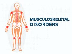 Musculoskeletal Disorders PowerPoint and Google Slides Template - PPT Slides