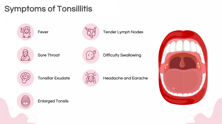 Tonsillitis PowerPoint and Google Slides Template - PPT Slides
