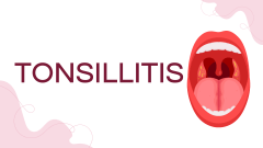 Tonsillitis PowerPoint and Google Slides Template - PPT Slides