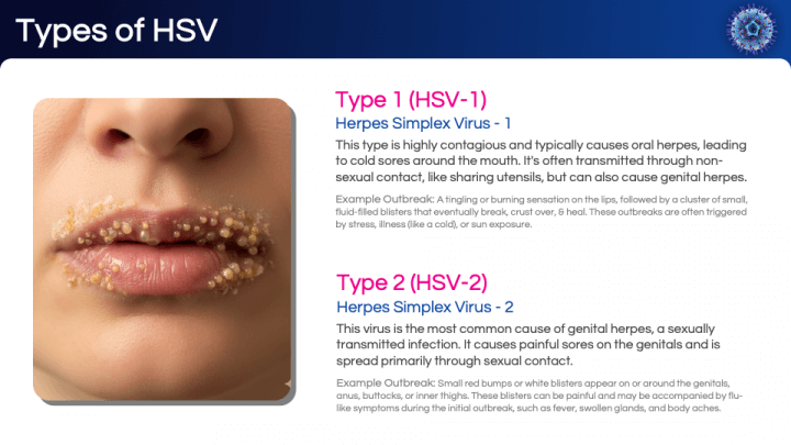 Herpes Simplex Virus (HSV) PowerPoint and Google Slides Template - PPT Slides