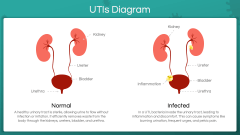 Urinary Tract Infection PowerPoint and Google Slides Template - PPT Slides
