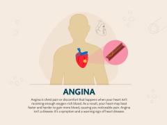 Angina PowerPoint and Google Slides Template - PPT Slides