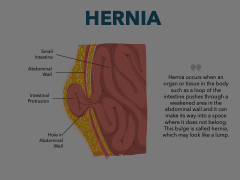 Anatomy Of Abdominal Wall Ppt Hernia Powerpoint