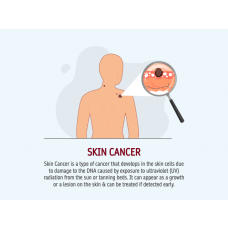 Breast Cancer PowerPoint Template and Google Slides Theme