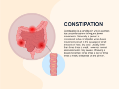 Constipation PowerPoint and Google Slides Template - PPT Slides