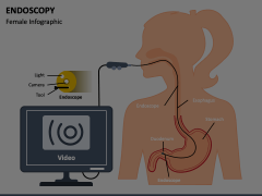 Endoscopy PowerPoint and Google Slides Template - PPT Slides