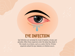 Eye Infection PowerPoint and Google Slides Template - PPT Slides