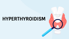 Hyperthyroidism PowerPoint and Google Slides Template - PPT Slides