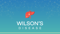 Free - Wilson's Disease PowerPoint and Google Slides Template - PPT Slides