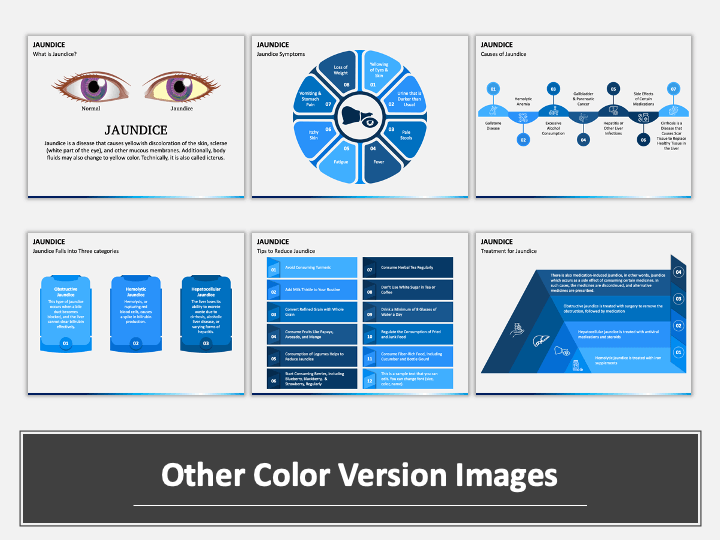 Free Jaundice PowerPoint and Google Slides Template - PPT Slides