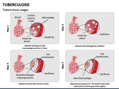 Free Tuberculosis PowerPoint and Google Slides Template - PPT Slides