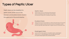 Peptic Ulcers PowerPoint and Google Slides Template - PPT Slides