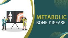 Metabolic Bone Disease PowerPoint and Google Slides Template - PPT Slides