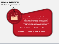 Fungal Infection PowerPoint and Google Slides Template - PPT Slides