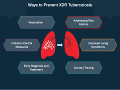 XDR Tuberculosis PowerPoint and Google Slides Template - PPT Slides