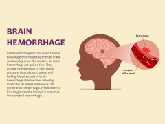 Brain Hemorrhage PowerPoint and Google Slides Template - PPT Slides