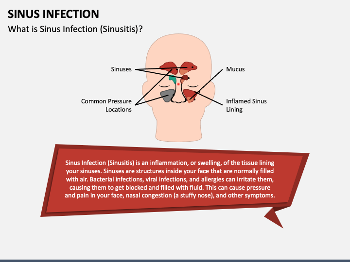 Sinus Infection PowerPoint and Google Slides Template - PPT Slides