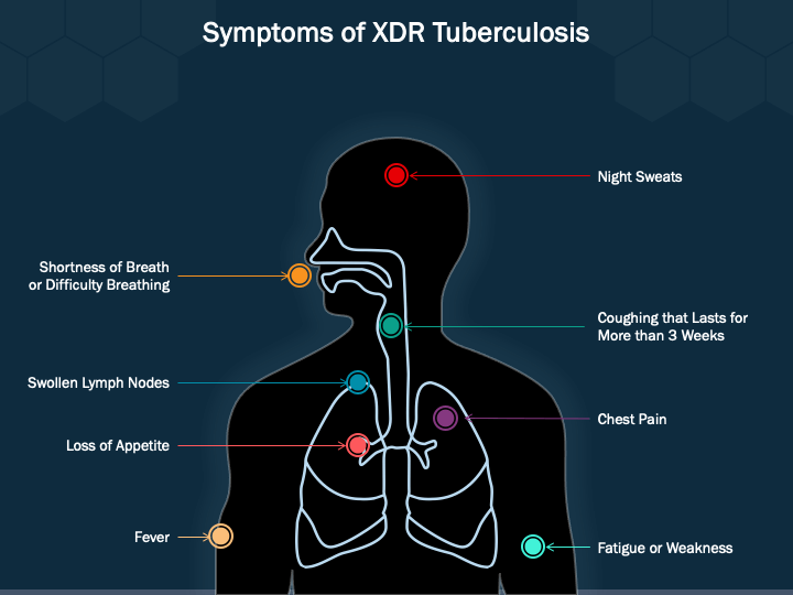 XDR Tuberculosis PowerPoint Template and Google Slides Theme