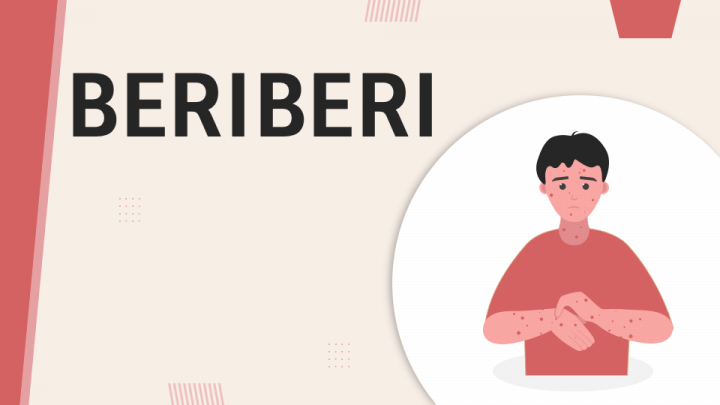 Beriberi PowerPoint and Google Slides Template - PPT Slides