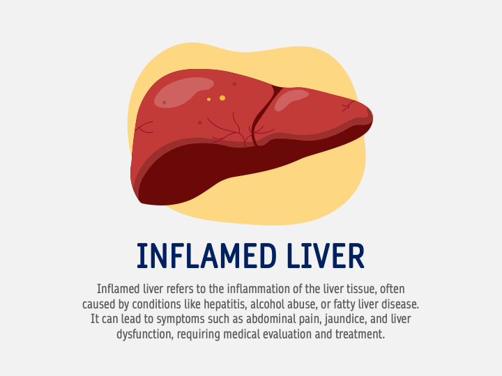 Inflamed Liver PowerPoint and Google Slides Template - PPT Slides