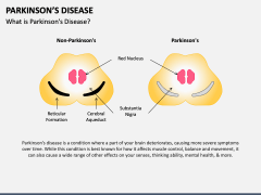 Free Parkinson's Disease PowerPoint and Google Slides Template - PPT Slides