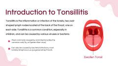 Tonsillitis PowerPoint and Google Slides Template - PPT Slides
