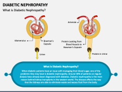 Diabetic Nephropathy PowerPoint and Google Slides Template - PPT Slides