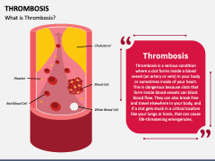 Free - Thrombosis PowerPoint and Google Slides Template - PPT Slides