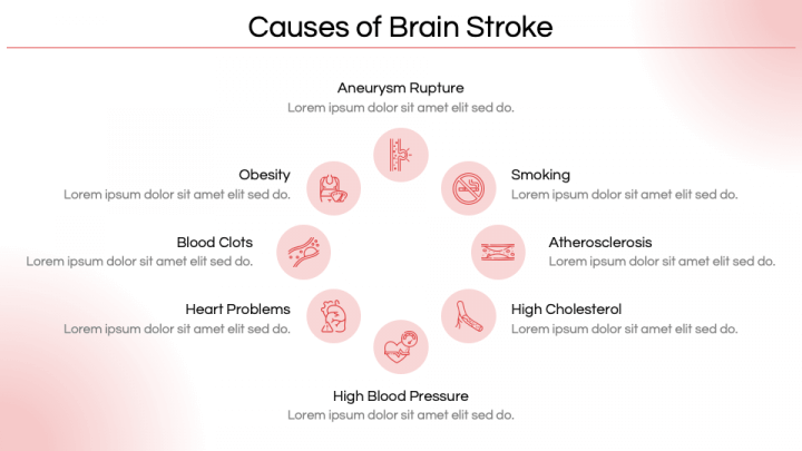 Brain Stroke PowerPoint and Google Slides Template - PPT Slides