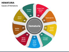 Hematuria PowerPoint and Google Slides Template - PPT Slides