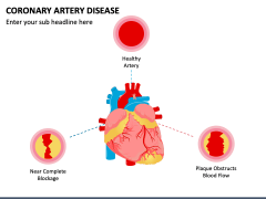 Coronary Artery Disease PowerPoint and Google Slides Template - PPT Slides