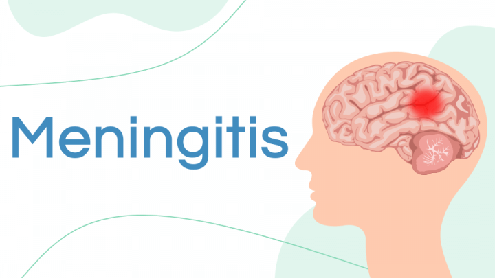 Meningitis PowerPoint and Google Slides Template - PPT Slides