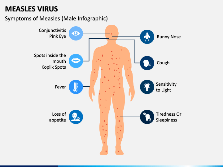 Measles Virus PowerPoint and Google Slides Template - PPT Slides